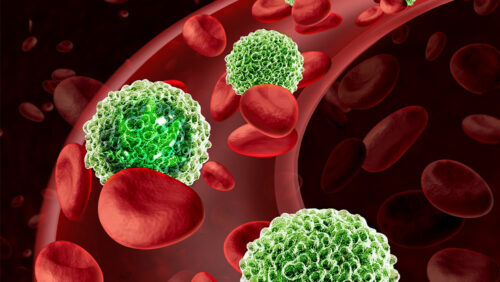 Cannabis for Lupus: Here's How Cannabinoids Relieve Inflammation